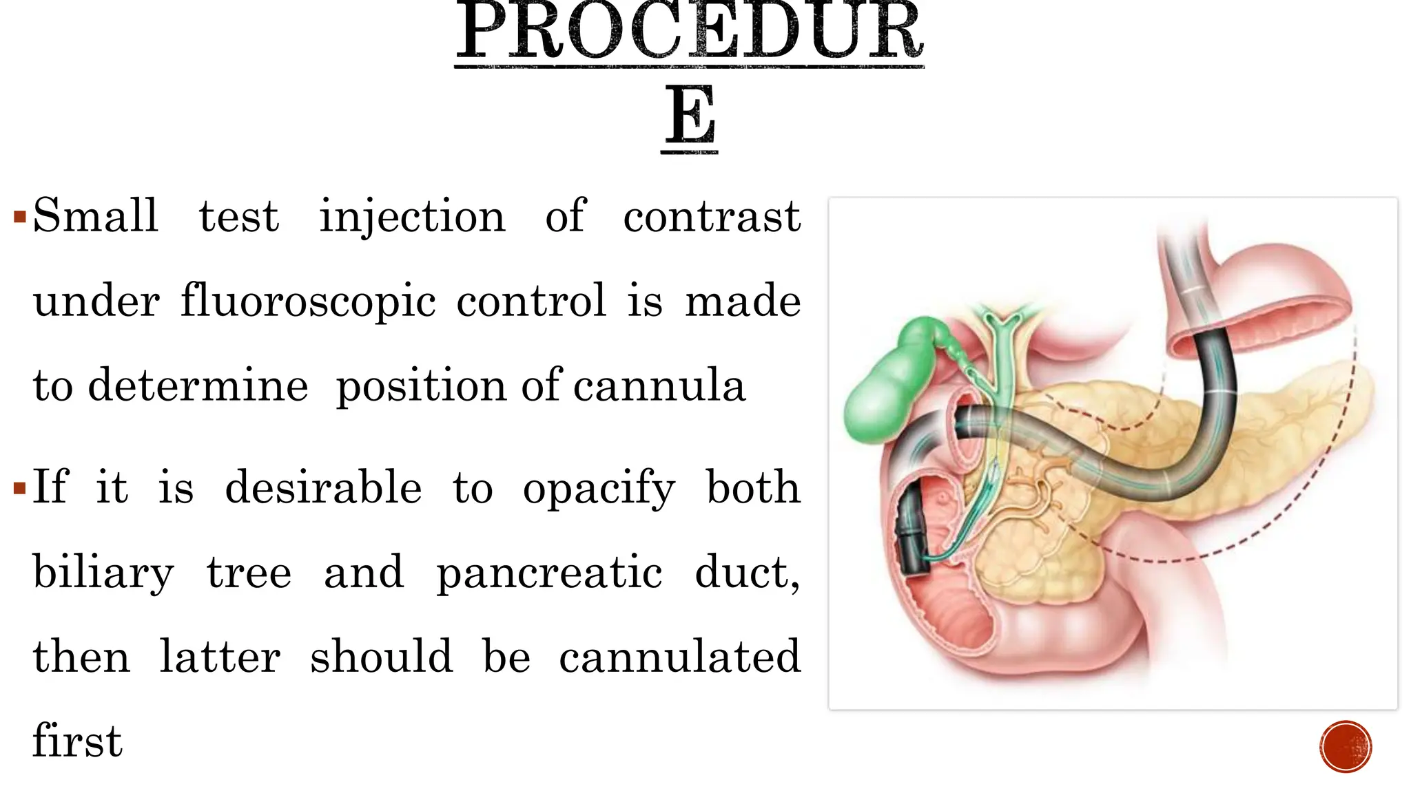 (ERCP) Cholangiopancreatography Bile ducts procedure | PPTX