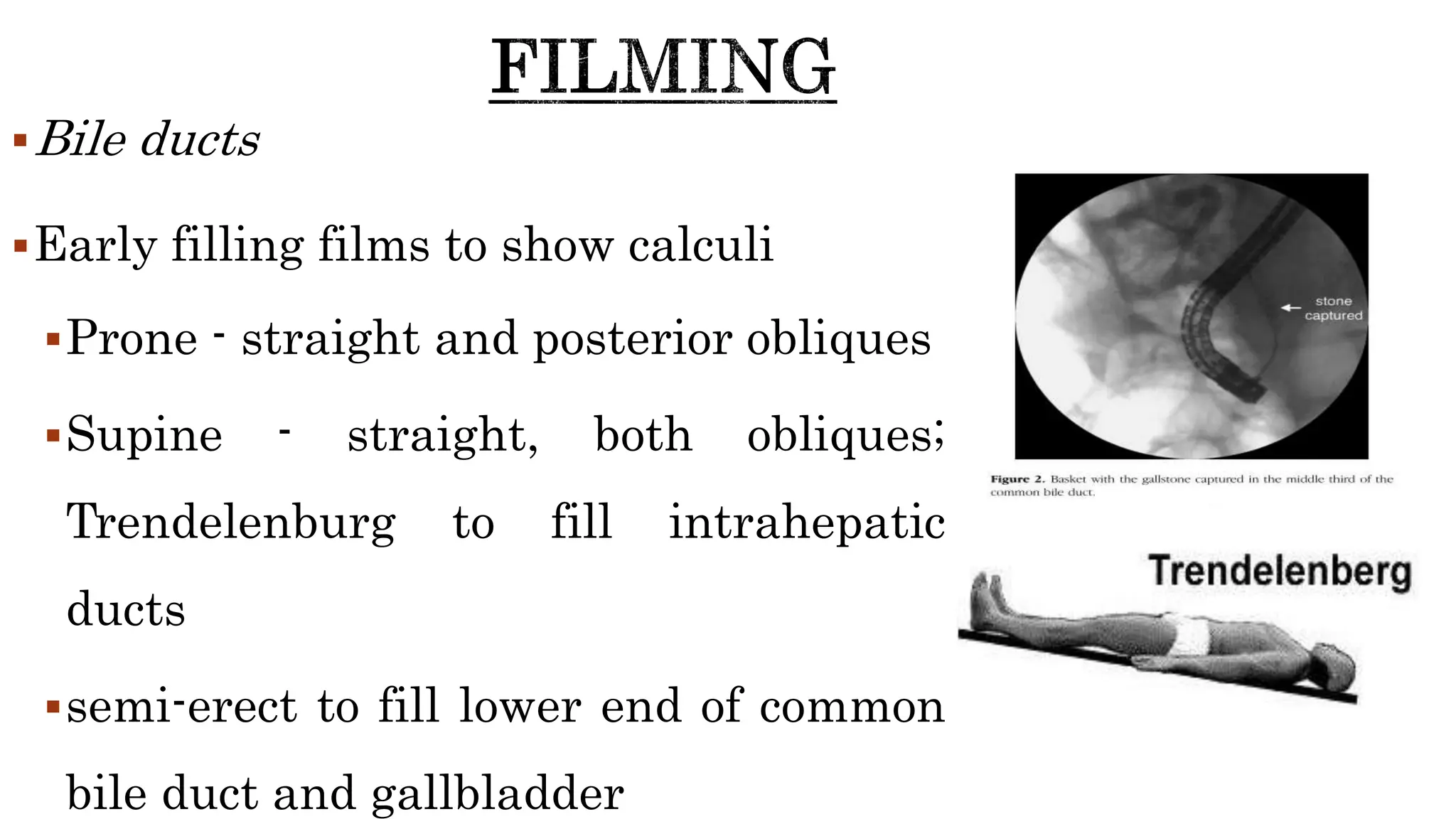 (ERCP) Cholangiopancreatography Bile ducts procedure | PPTX