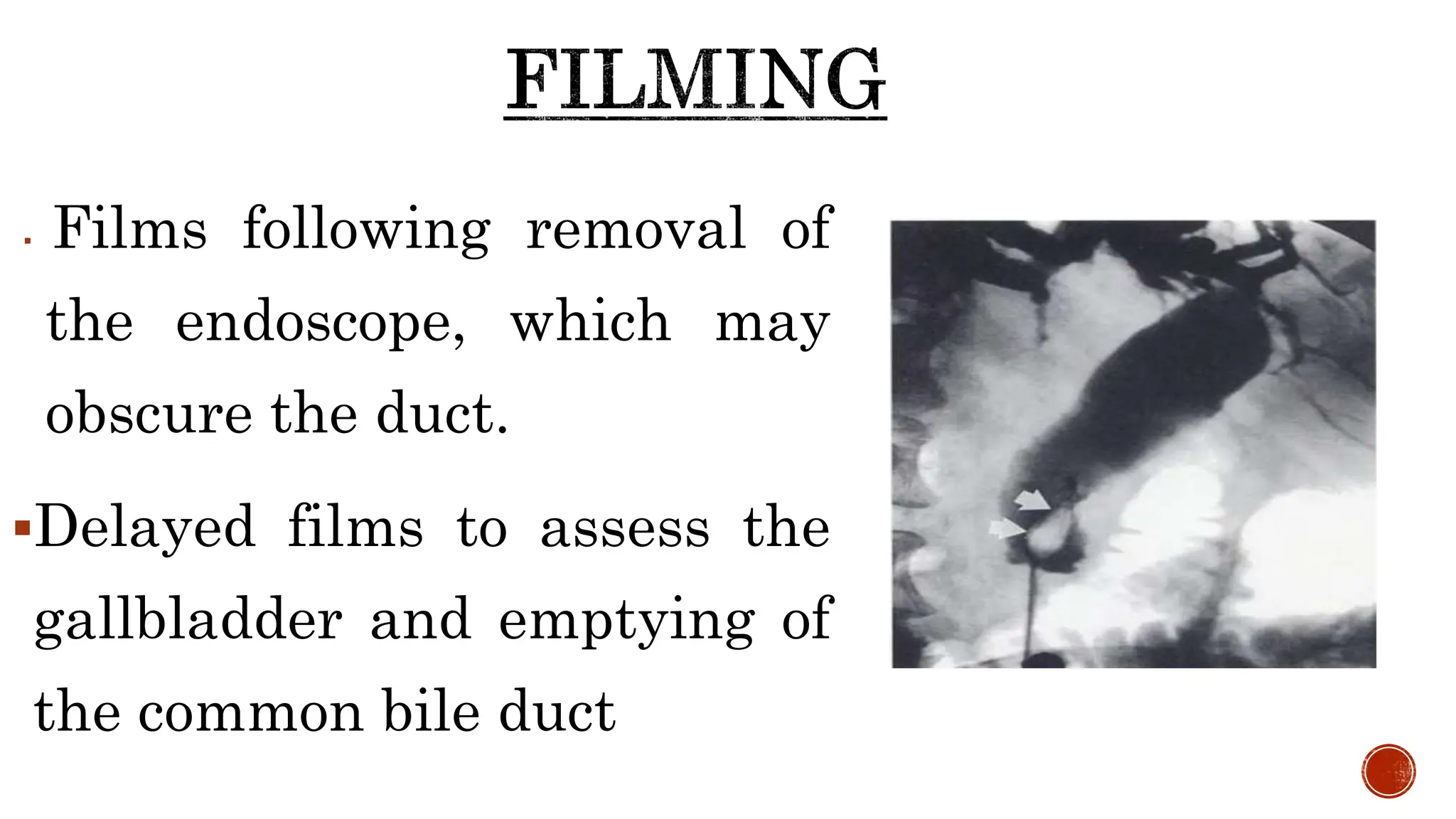 (ERCP) Cholangiopancreatography Bile ducts procedure | PPTX