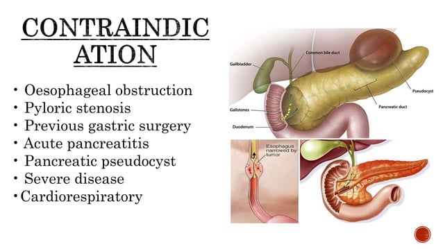 (ERCP) Cholangiopancreatography Bile ducts procedure | PPTX | Digestive Disorders | Diseases and ...