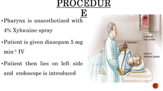 (ERCP) Cholangiopancreatography Bile ducts procedure | PPTX