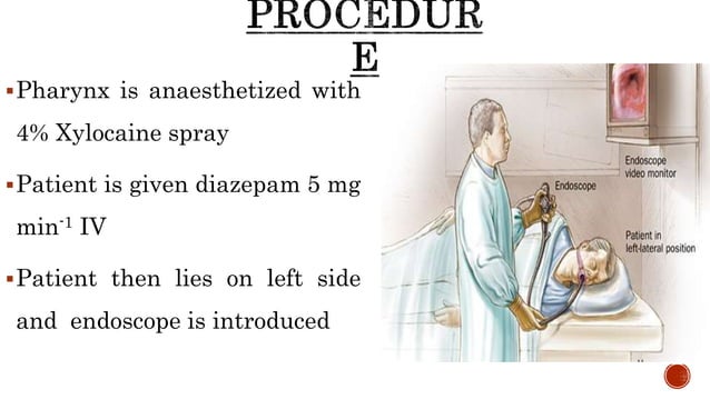 (ERCP) Cholangiopancreatography Bile ducts procedure | PPTX | Digestive Disorders | Diseases and ...