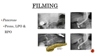 (ERCP) Cholangiopancreatography Bile ducts procedure | PPTX