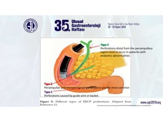 ERCP isleminde hemsirenin rolu | PPT