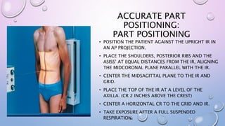 Erect Abdomen Final Image Evaluation 2017 | PPTX