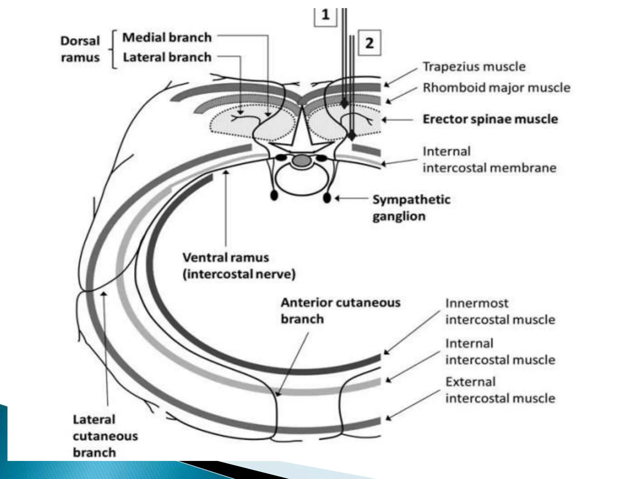Erector spinae plane block for pain management | PPTX