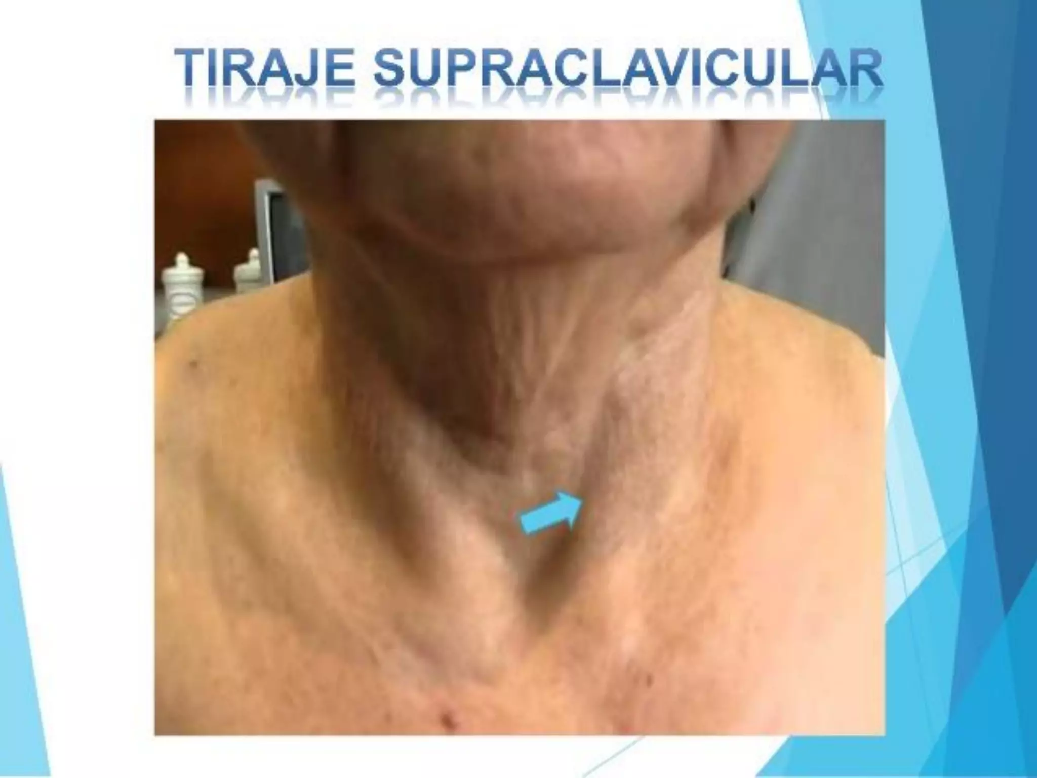 ANATOMIA DE CORTE - region supra e infra | PPT