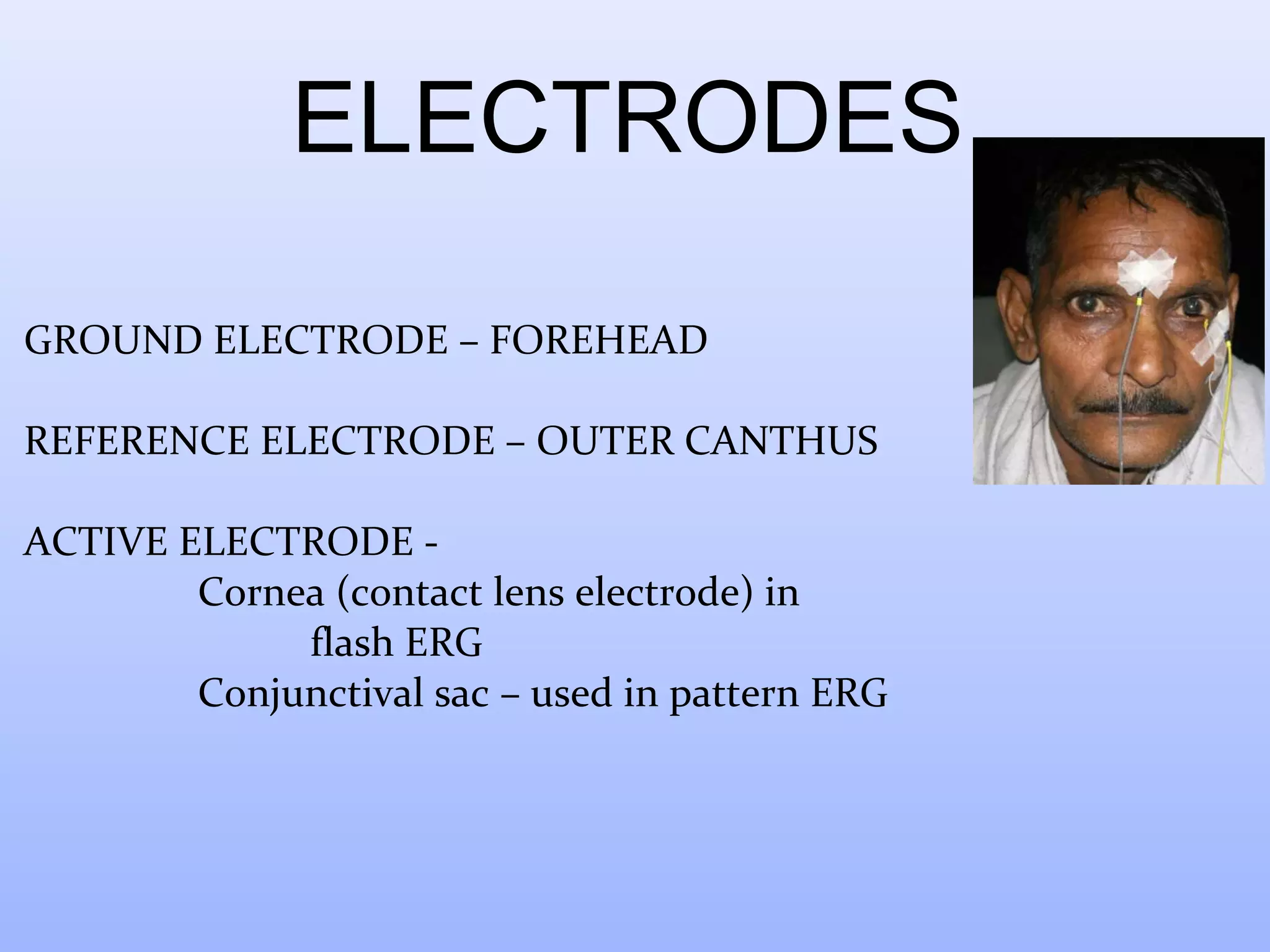 Electrophysiology (ERG and EOG) Simplified........ | PPTX