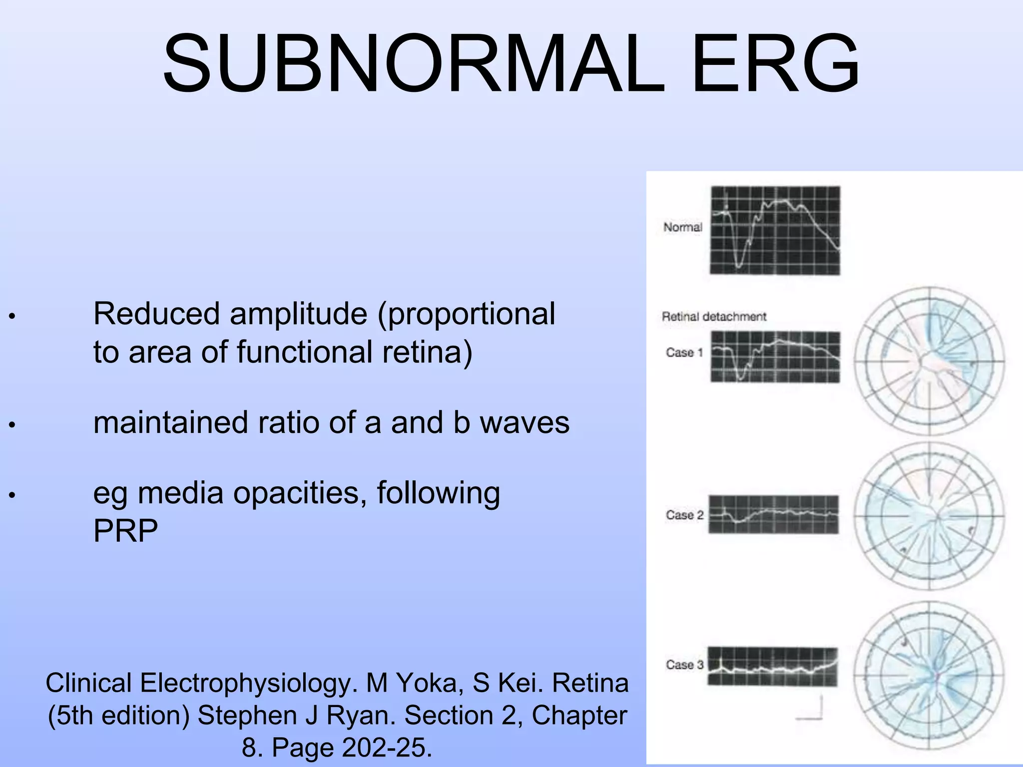 Electrophysiology (ERG and EOG) Simplified........ | PPTX