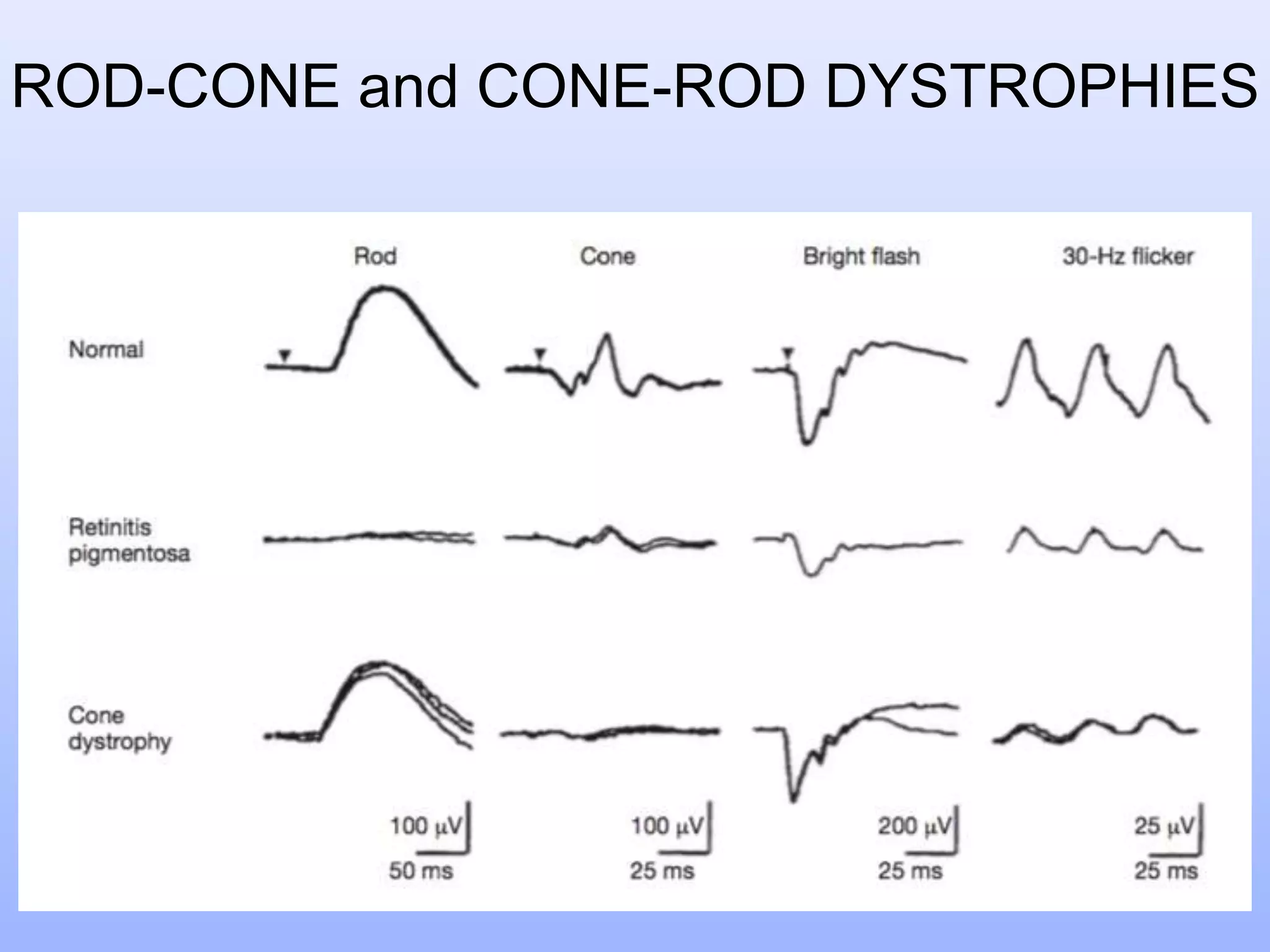 Electrophysiology (ERG and EOG) Simplified........ | PPTX