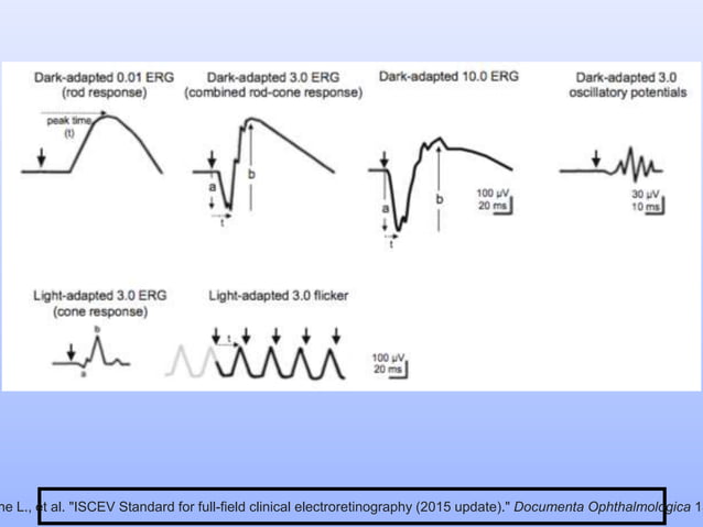 Electrophysiology (ERG and EOG) Simplified........ | PPTX | Eye and ...