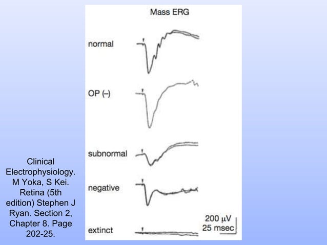 Electrophysiology (ERG and EOG) Simplified........ | PPTX | Eye and ...