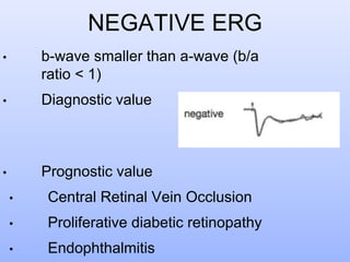 Electrophysiology (ERG and EOG) Simplified........ | PPTX