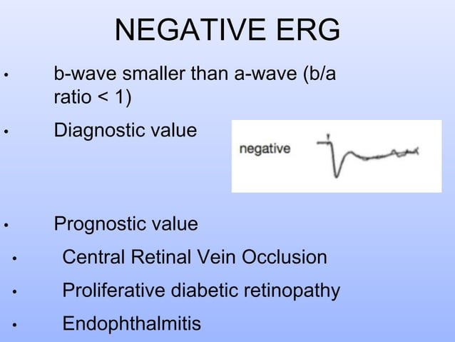 Electrophysiology (ERG and EOG) Simplified........ | PPTX | Eye and ...