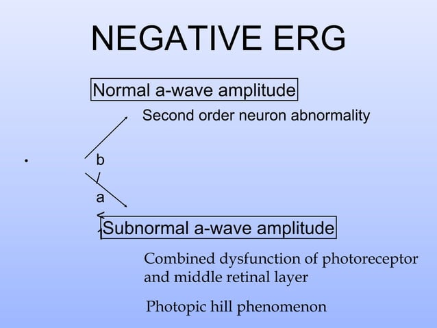 Electrophysiology (ERG and EOG) Simplified........ | PPTX | Eye and ...