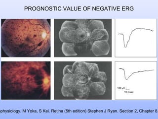 Electrophysiology (ERG and EOG) Simplified........ | PPTX