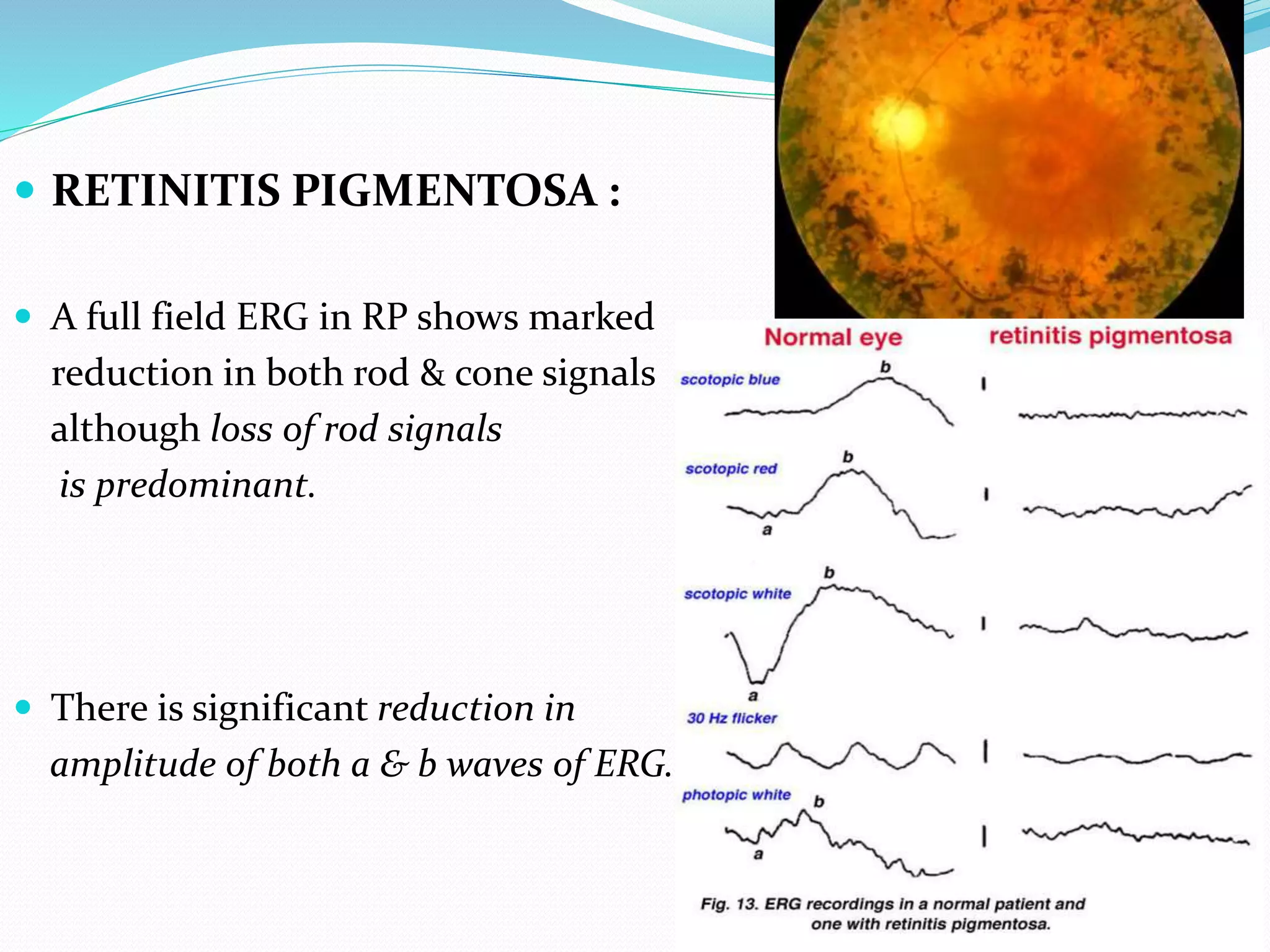 Erg and eog | PPTX