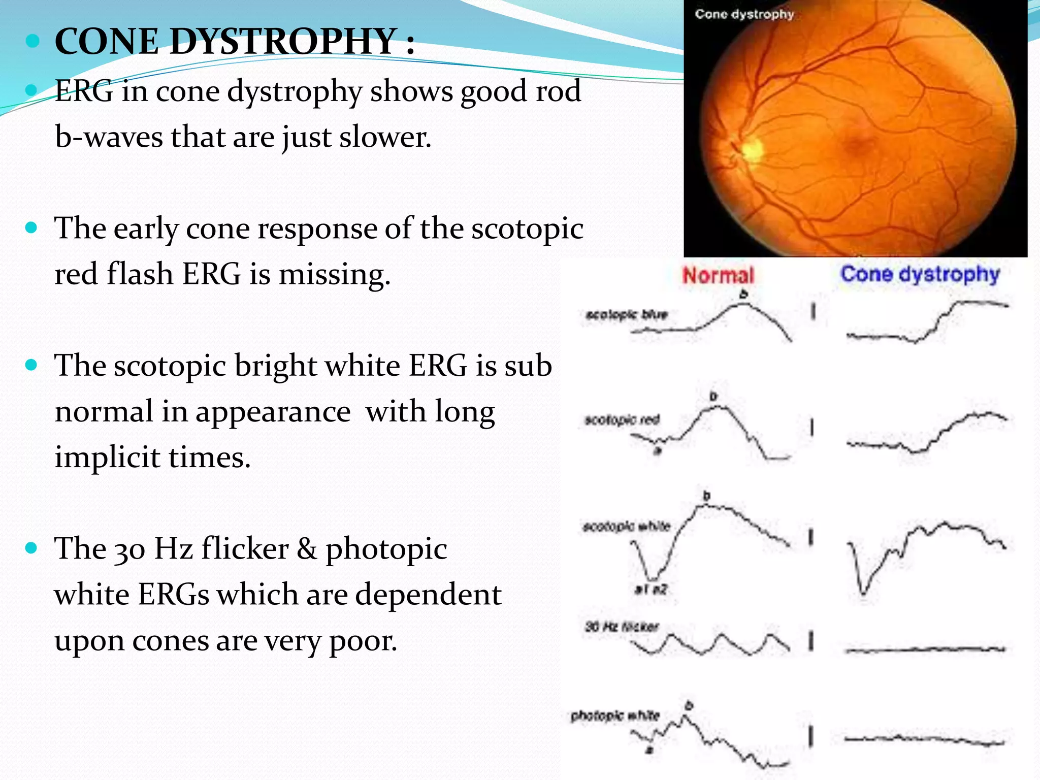 Erg and eog | PPTX