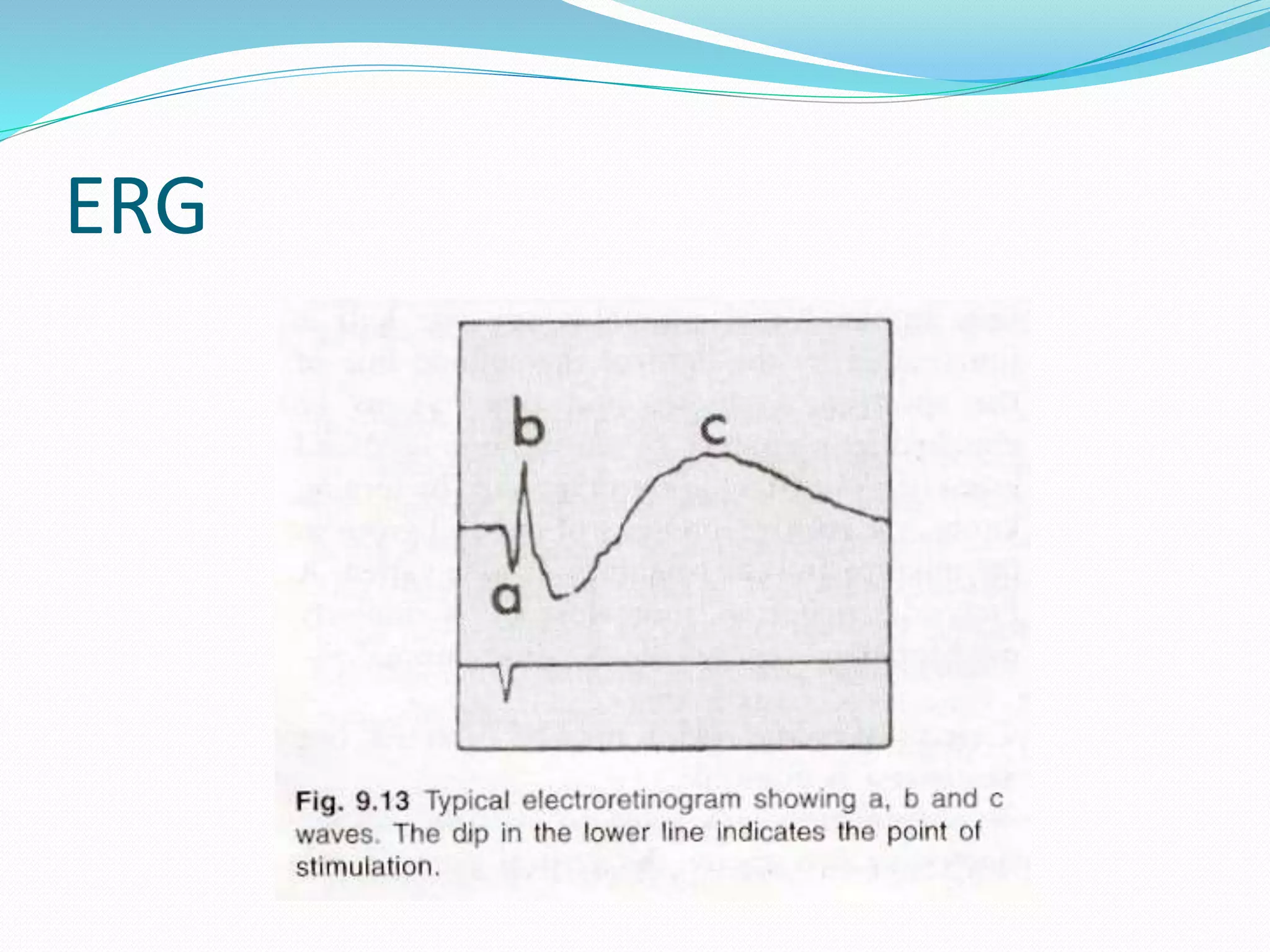 Erg and eog | PPTX | Eye and Vision Conditions | Diseases and Conditions
