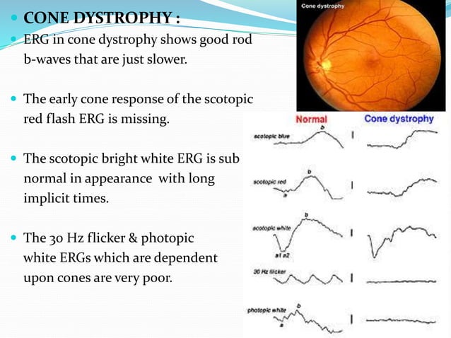 Erg and eog | PPTX | Eye and Vision Conditions | Diseases and Conditions