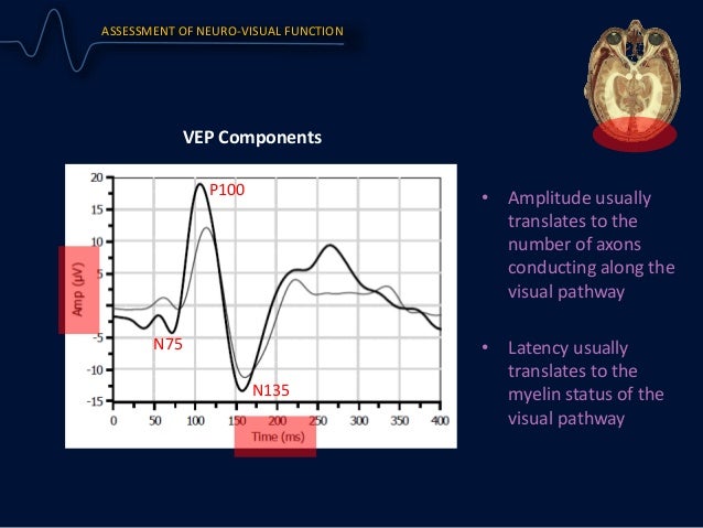 How Vep And Erg Have Shaped Paediatric Diagnosis London