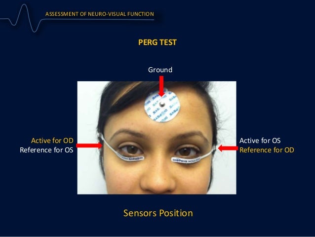 ERG and VEP Lecture sept 20, 2015