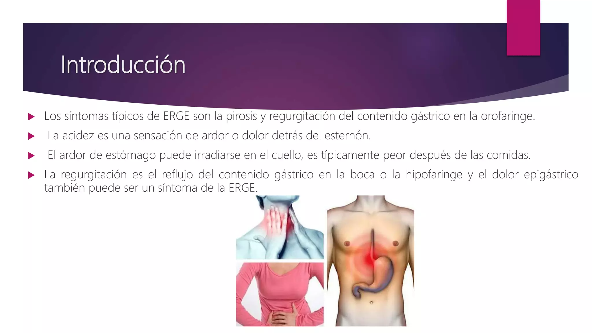 enfermedad por reflujo gastroesofágico | PPTX