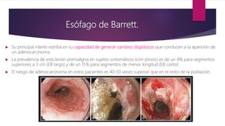 enfermedad por reflujo gastroesofágico | PPTX