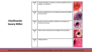 Enfermedad por reflujo gastroesofágico | PPTX