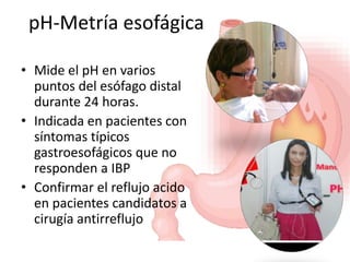 Diagnóstico y tratamiento de La enfermedad por reflujo Gastroesofágico ...