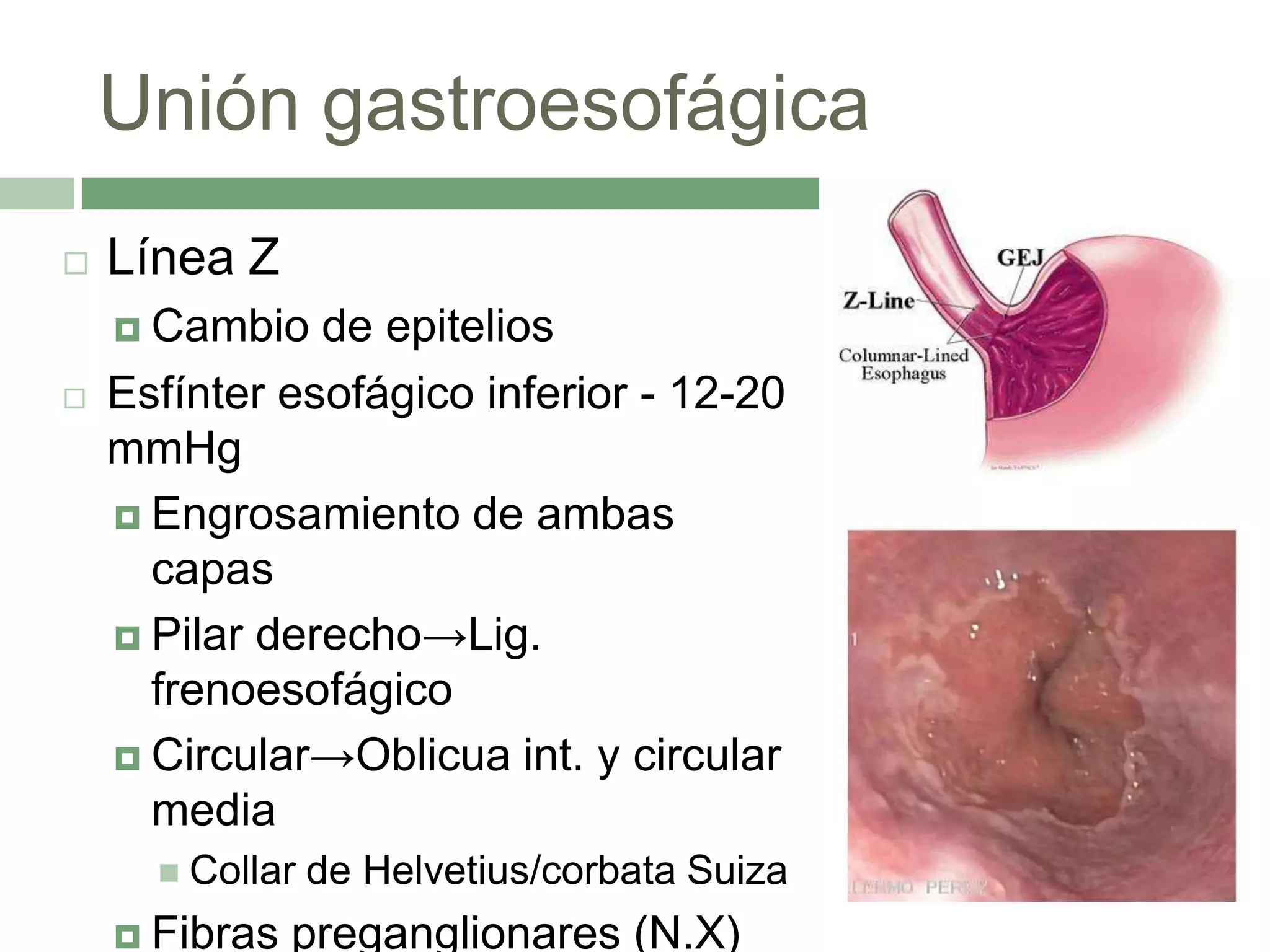 Erge y hernia hiatal | PPTX