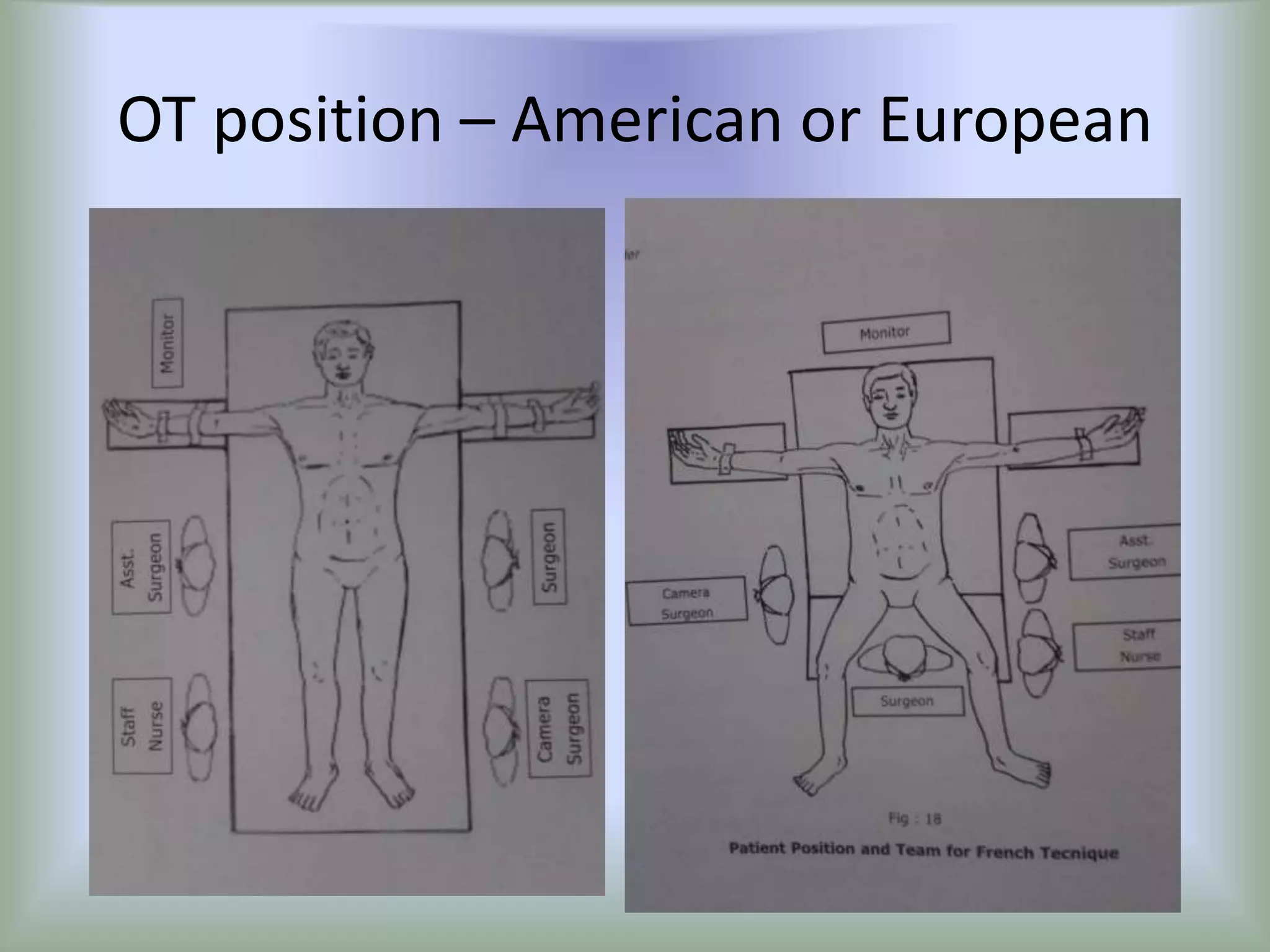 Ergonomics in laparoscopic surgery | PPTX