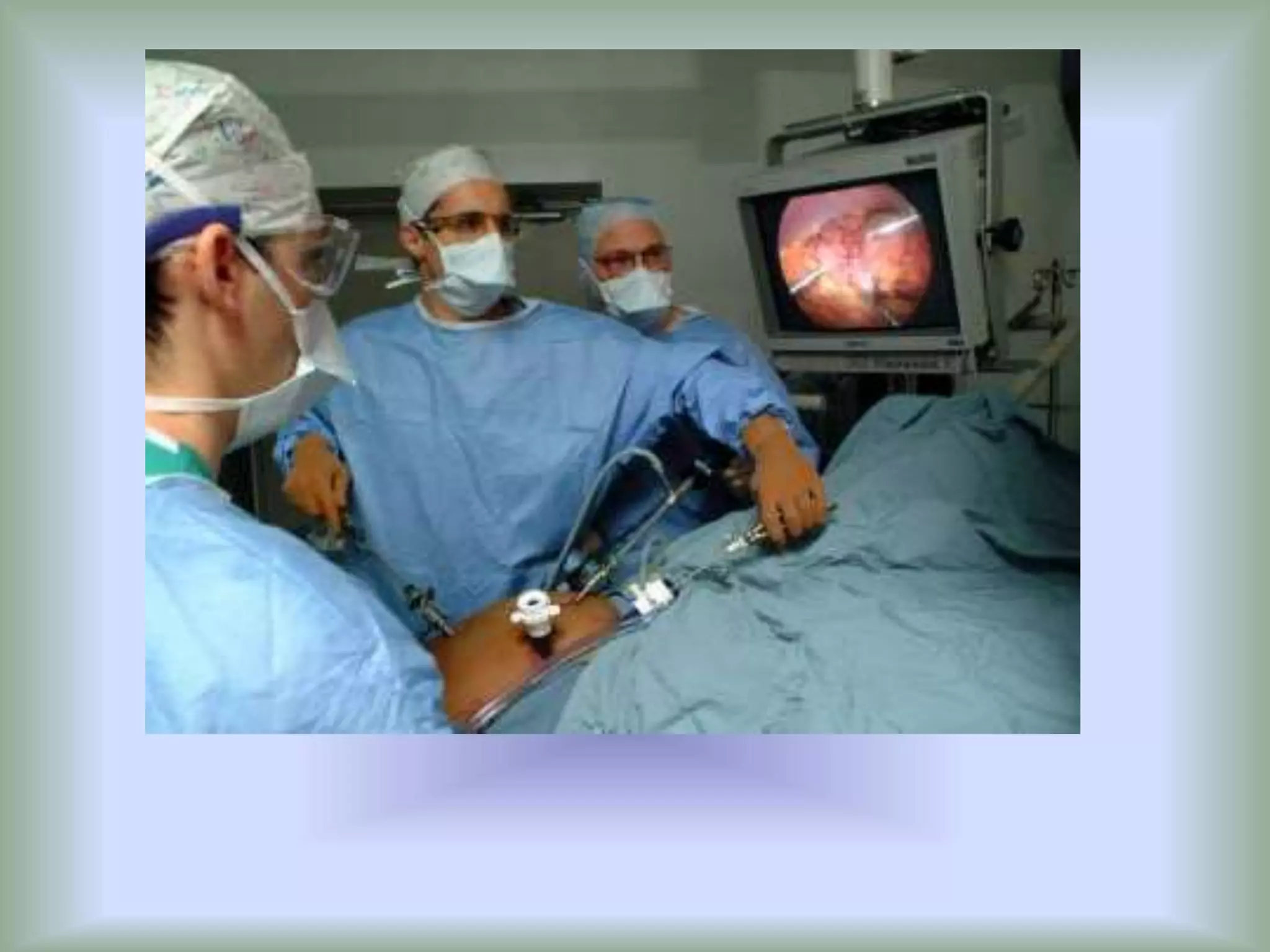 Ergonomics in laparoscopic surgery | PPTX