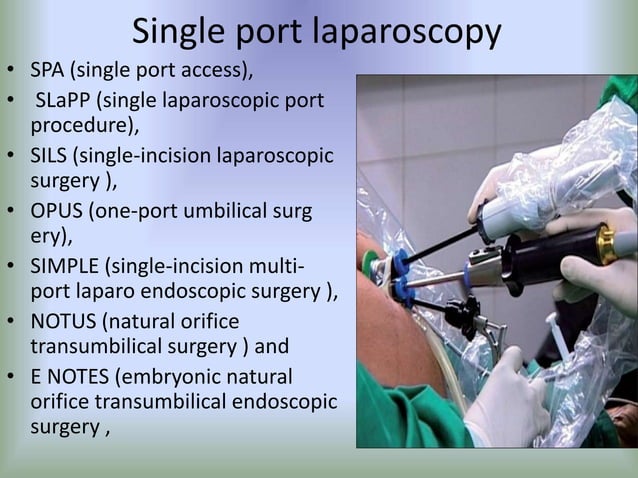 Ergonomics in laparoscopic surgery | PPTX | Physical Therapy | Wellness