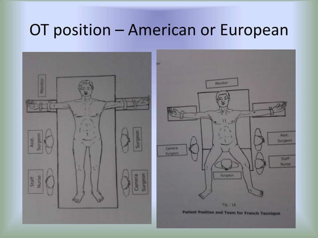 Ergonomics in laparoscopic surgery | PPTX | Physical Therapy | Wellness