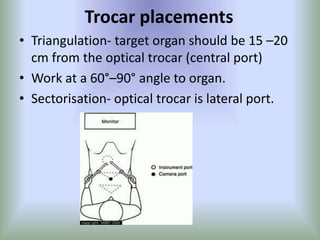 Ergonomics in laparoscopic surgery | PPTX