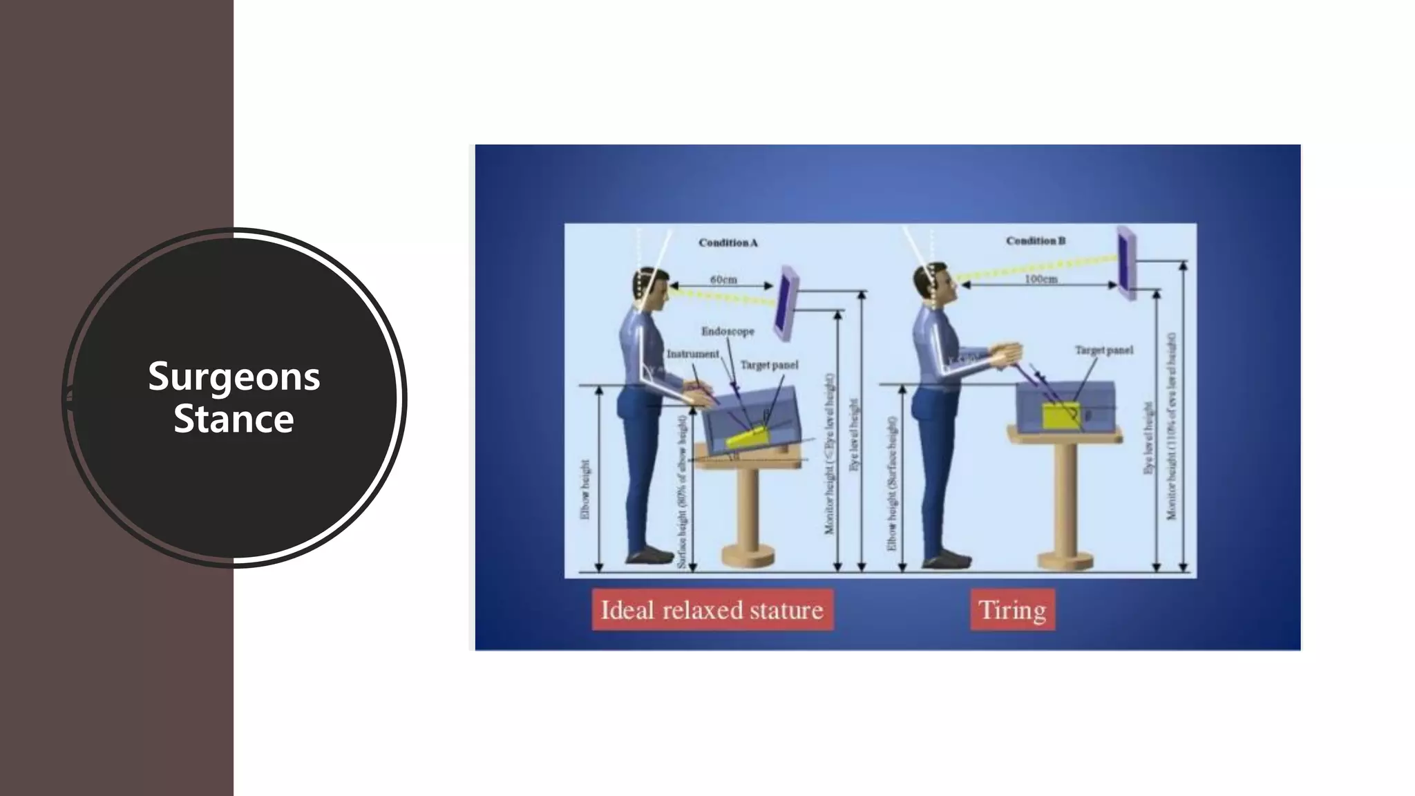 Ergonomics in minimal access surgery | PDF