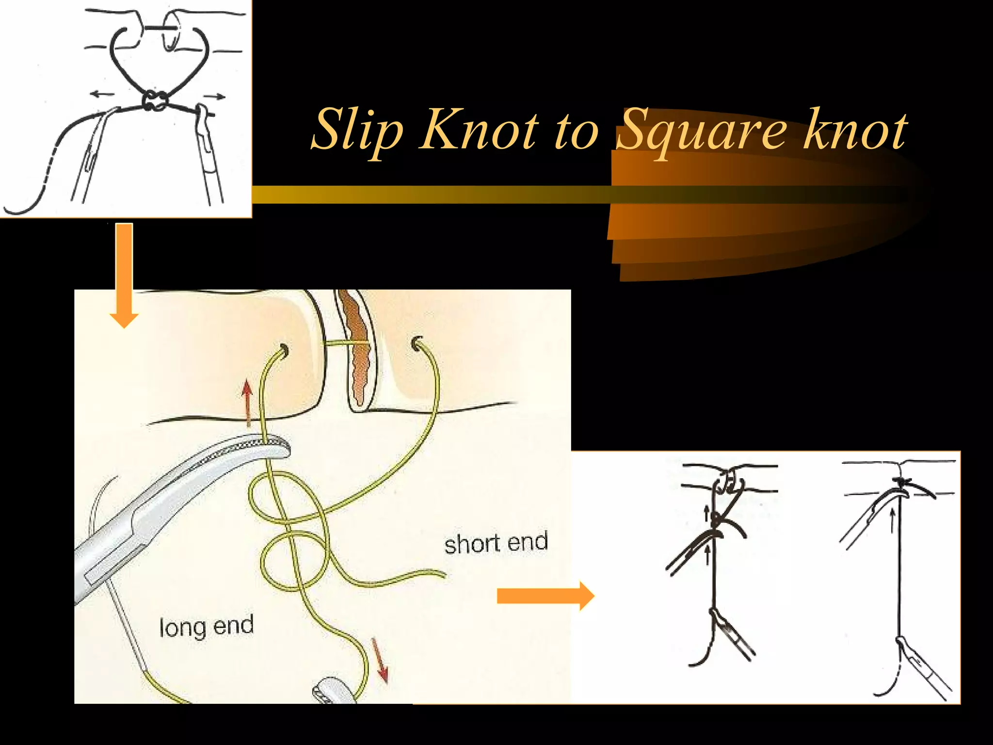 laparoscopic suturing | PPT