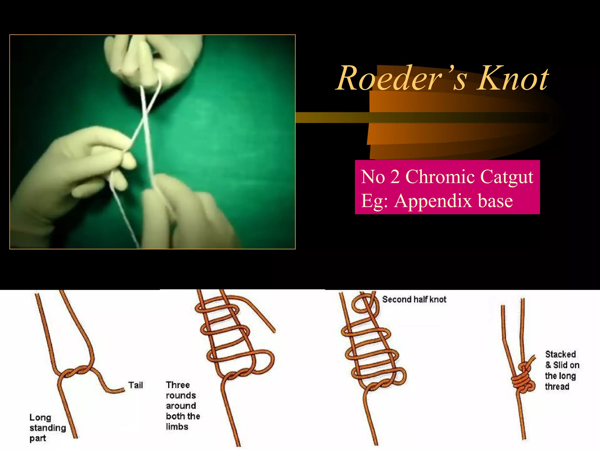 laparoscopic suturing | PPT