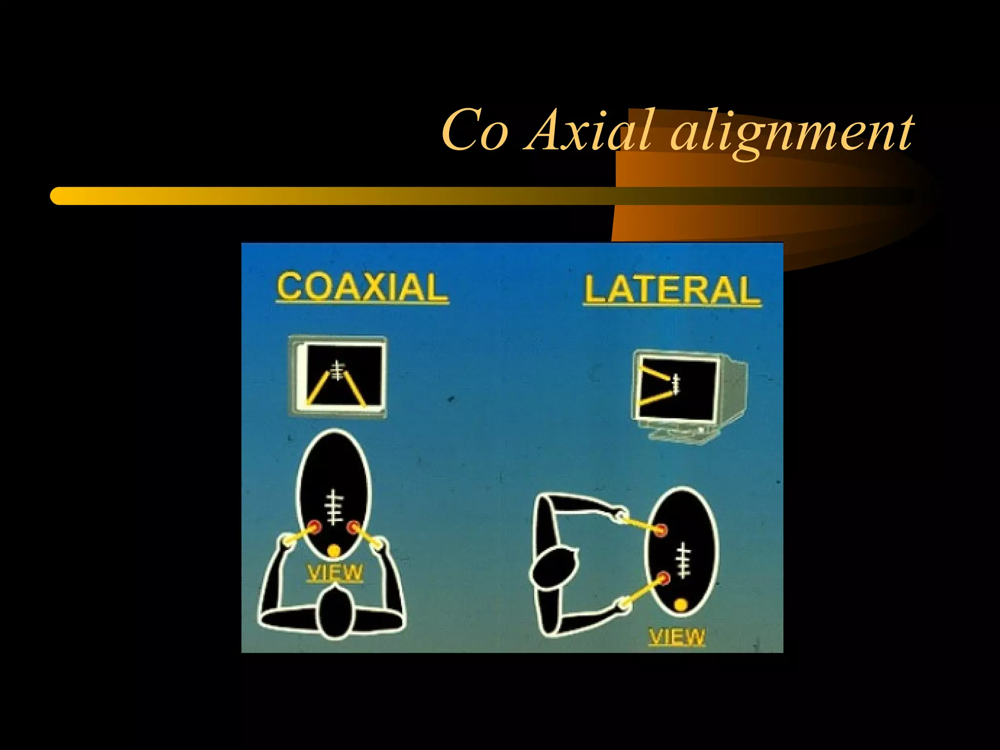 Ergonomics for laparoscopic surgeon | PPT