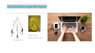 Ergonomics n Laparoscopic Surgery.pptx