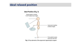 Ergonomics n Laparoscopic Surgery.pptx