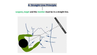 Ergonomics n Laparoscopic Surgery.pptx