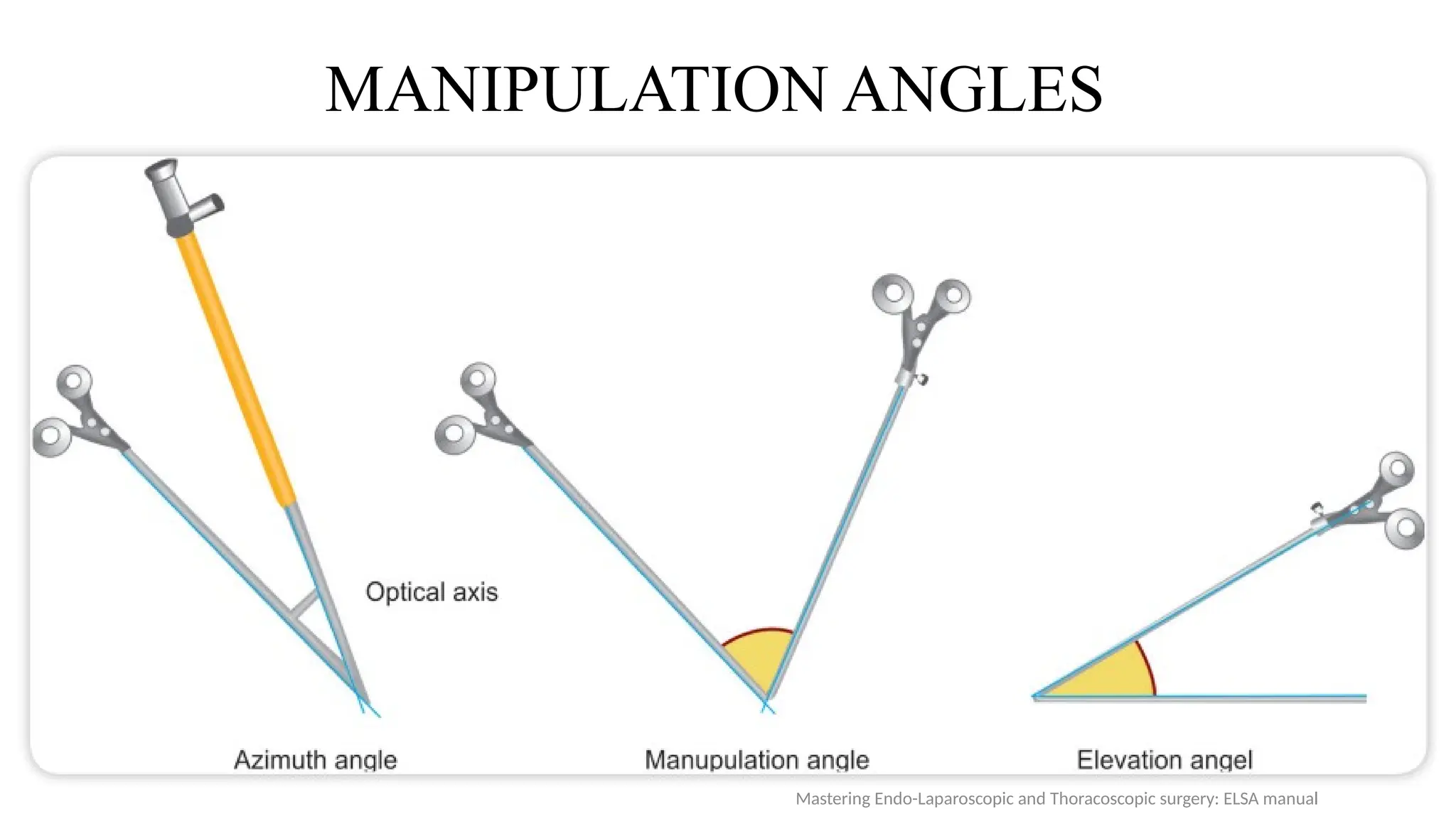 Ergonomics of laparoscopic surgery surgery | PPTX