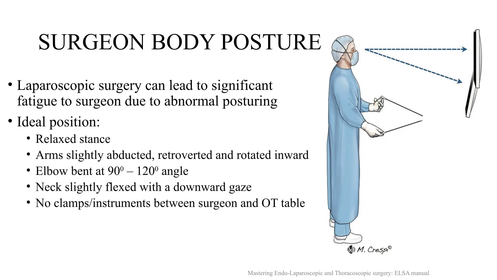 Ergonomics of laparoscopic surgery surgery | PPTX