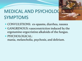 Ergotism-SEC.A | PPTX