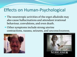 Ergotism-SEC.A | PPTX