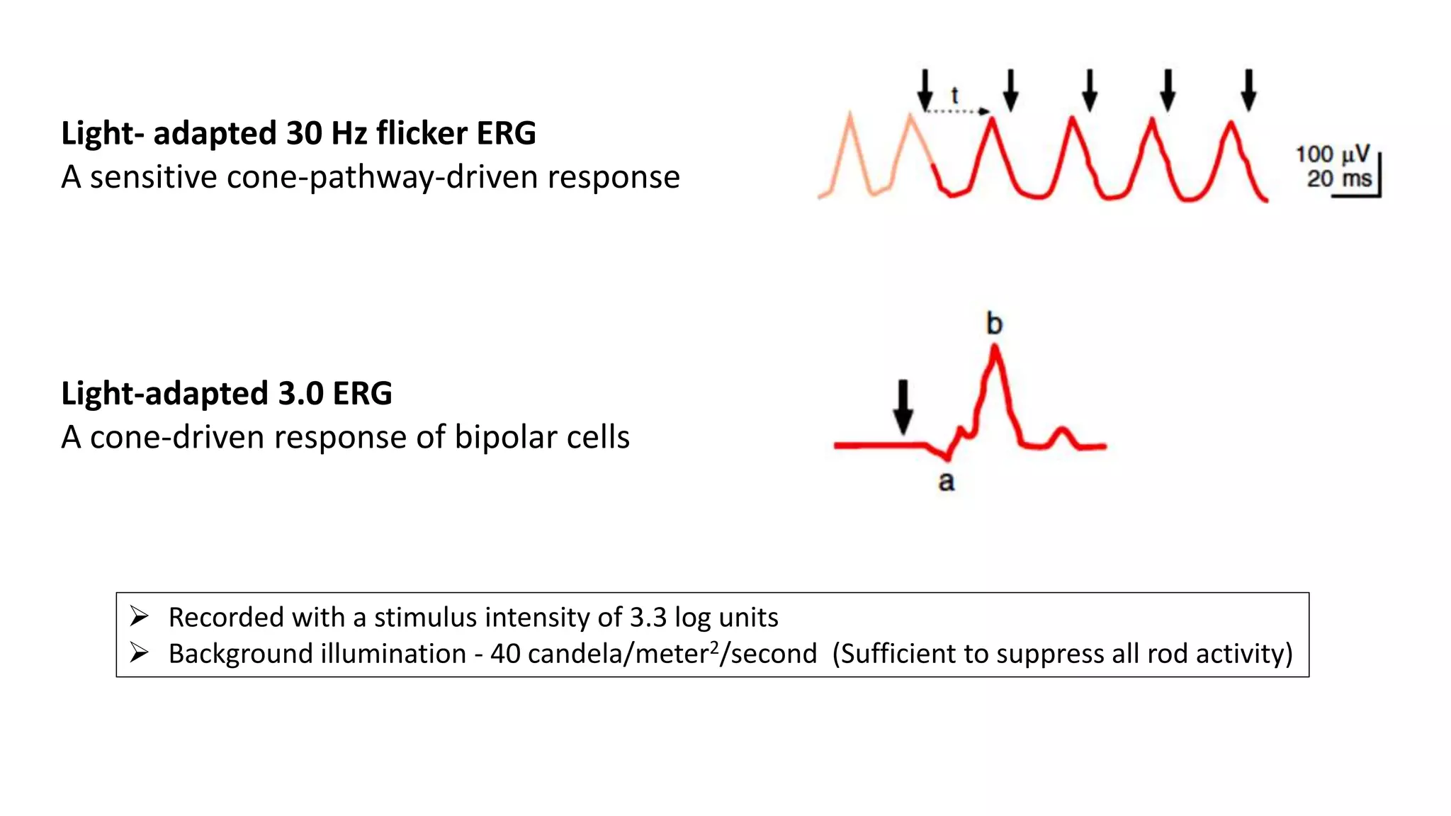 Electroretinogram and Clinical Applications | PPTX