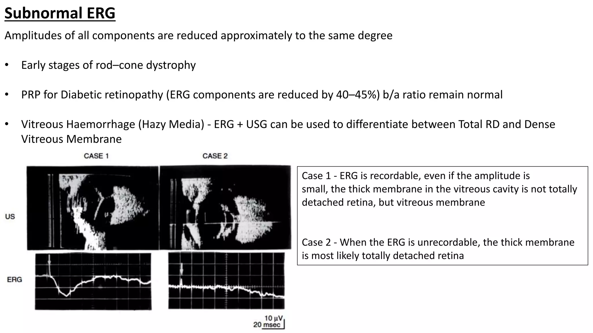Electroretinogram and Clinical Applications | PPTX