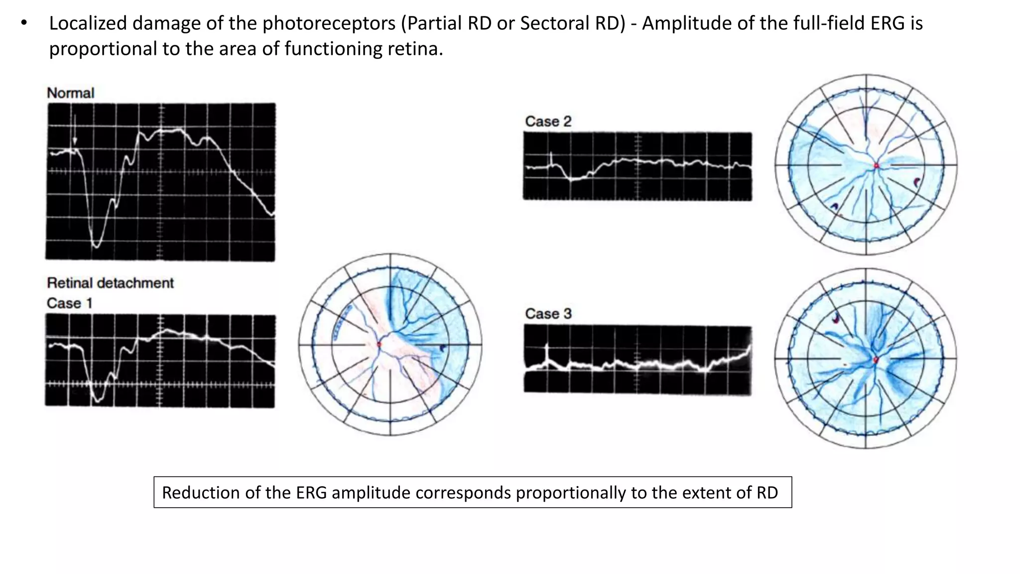 Electroretinogram and Clinical Applications | PPTX